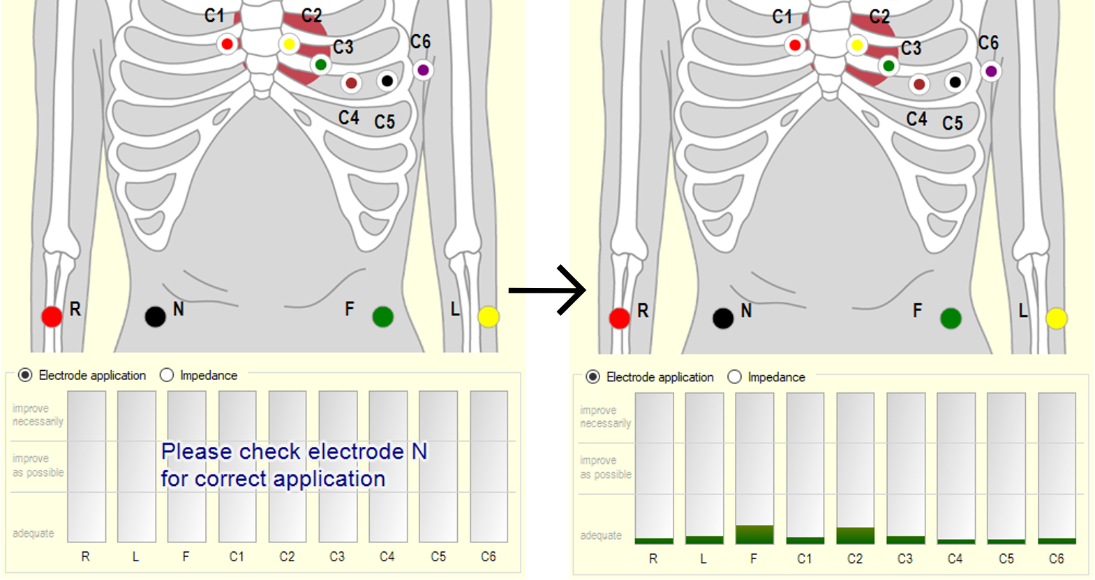 AMEDTEC ECG - LEMR with MedicalDirector Clinical | LEMR Wiki