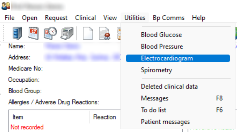 QRS ECG - LEMR with Best Practice (Bp Premier) | LEMR Wiki
